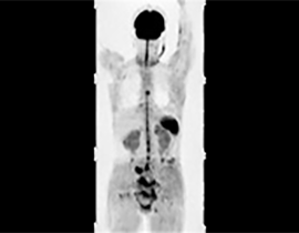 Magnetic Resonance Imaging | GE Healthcare