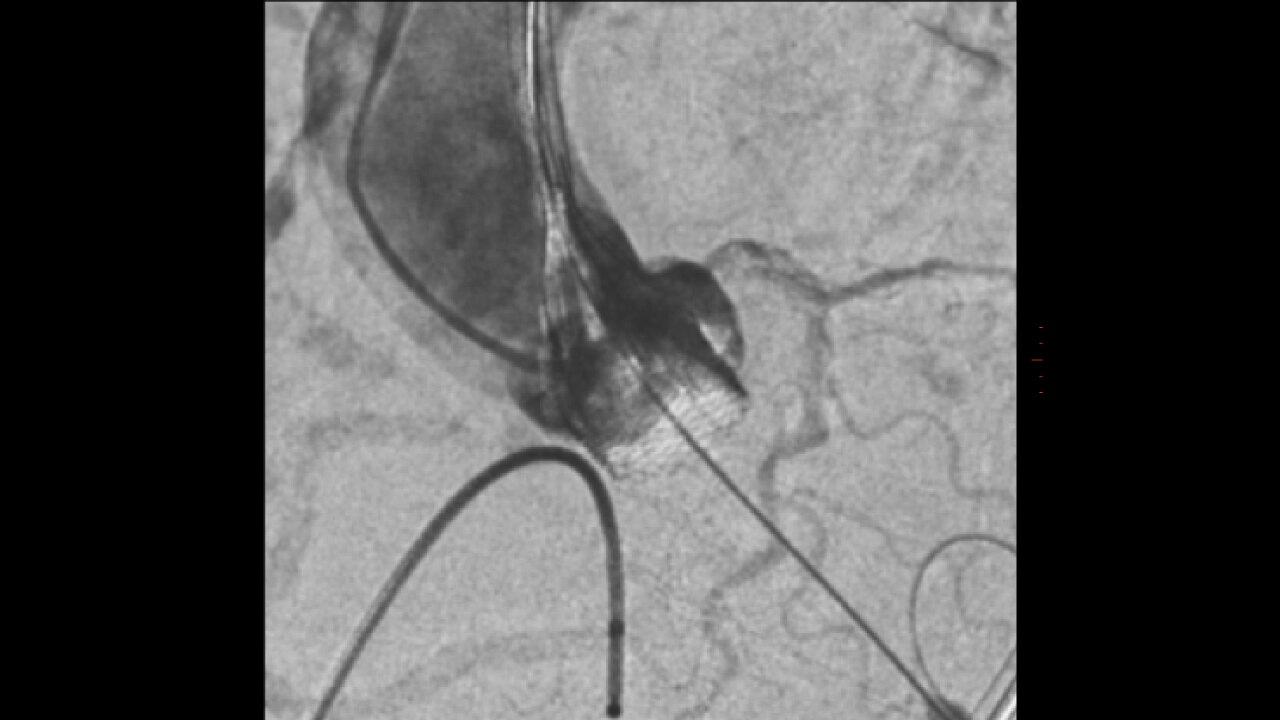 Valve ASSIST | GE HealthCare