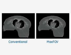Max Field | GE HealthCare