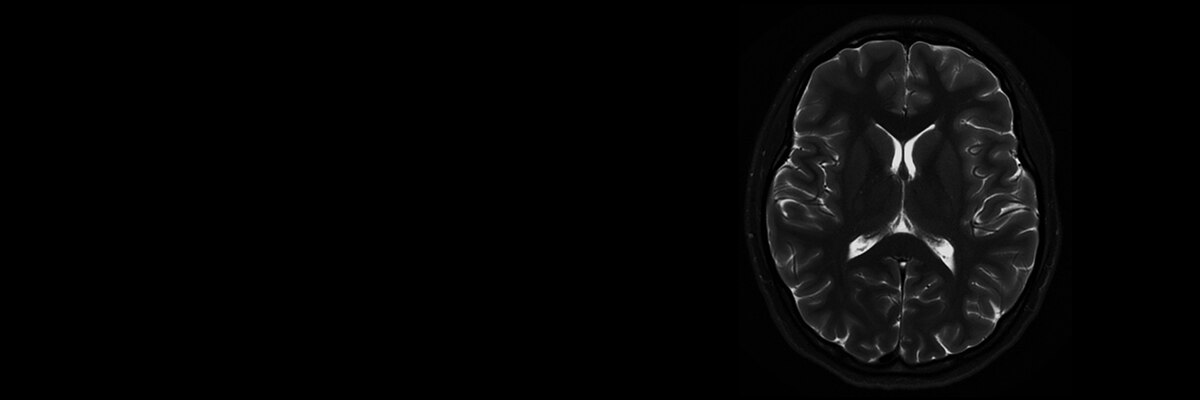 GEHC AIR Image Quality Webpage Overview Image 1